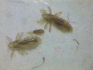Lice Season is Here | Westport, CT Patch
