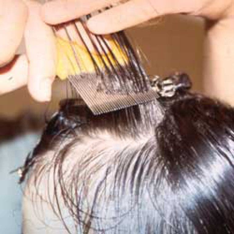 Have You Ever Gotten the Lice Letter? Here's a Survival Guide ...