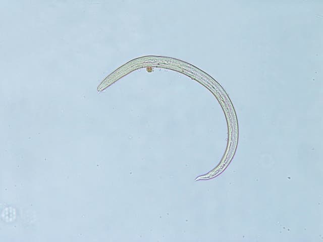 Invasive Parasite Found In Brown Rats Detected In Atlanta: New Study ...