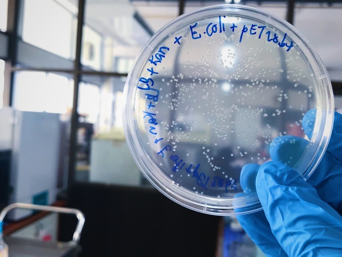 Texas Among States Hit by E. Coli Outbreak Tied to Raw Cheddar Cheese ...