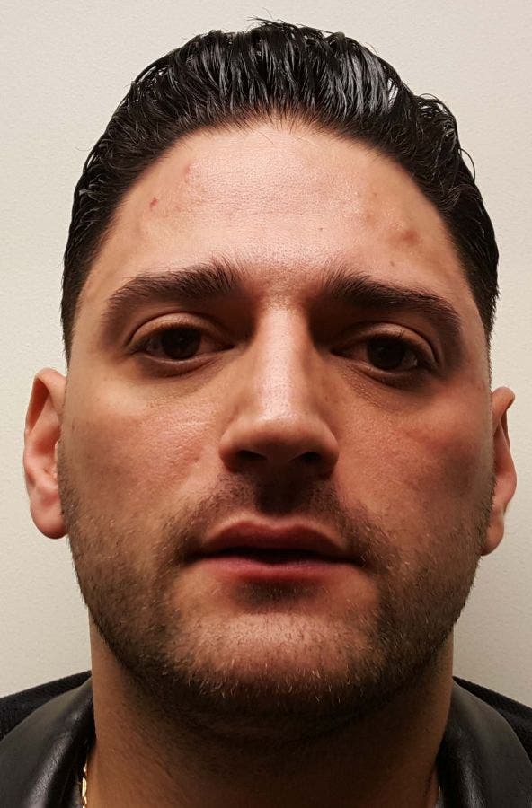 Police Officer From Wayne Charged With Assault | Wayne, NJ Patch
