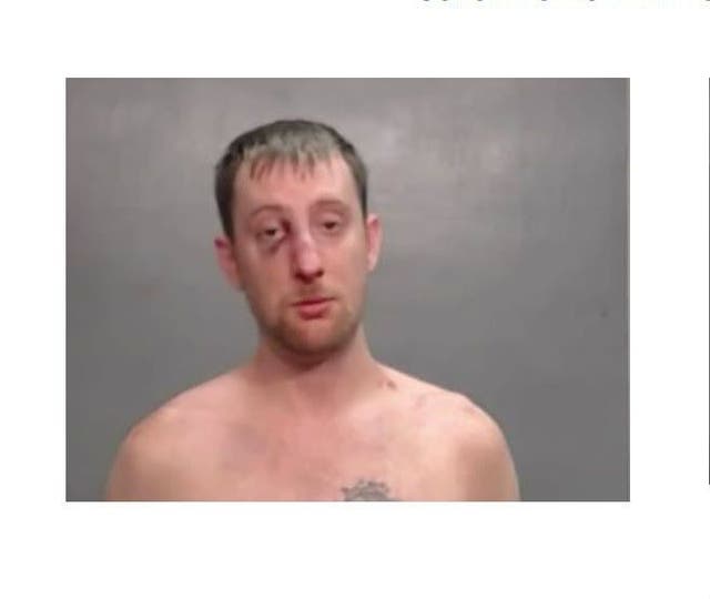 Drunken Bloody Brawl Between Brothers Leads to Arrests: Solon Police ...