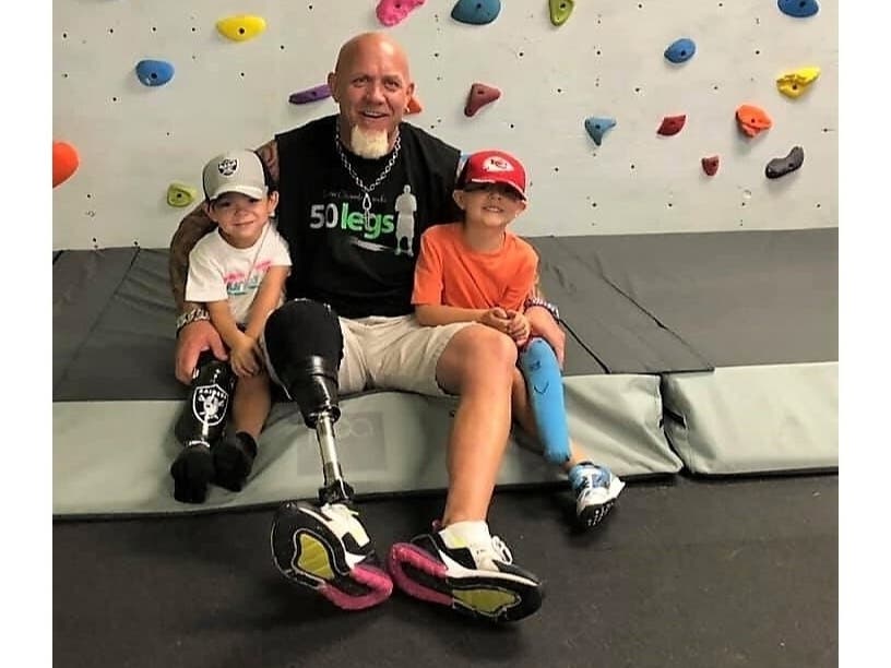 Founder Of Charity That Provides Prosthetics Now Faces Own Crisis ...
