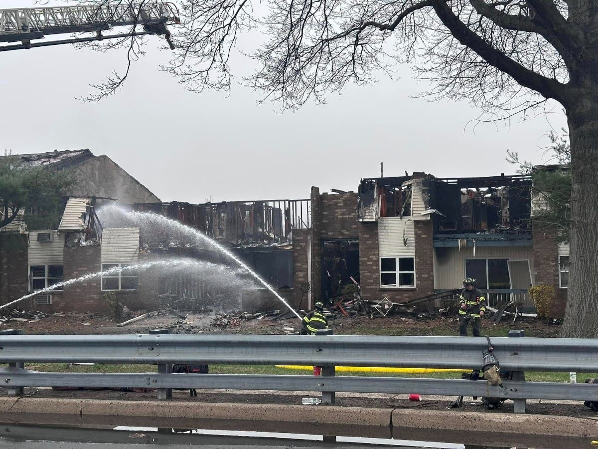 Fire Burns Dozens Of Apartments In Edison, 3 People Injured | Edison ...