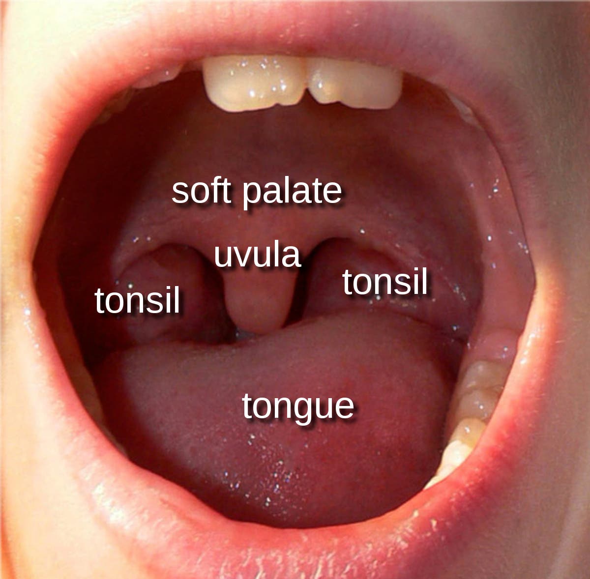 Uvula Phoenixville PA Patch