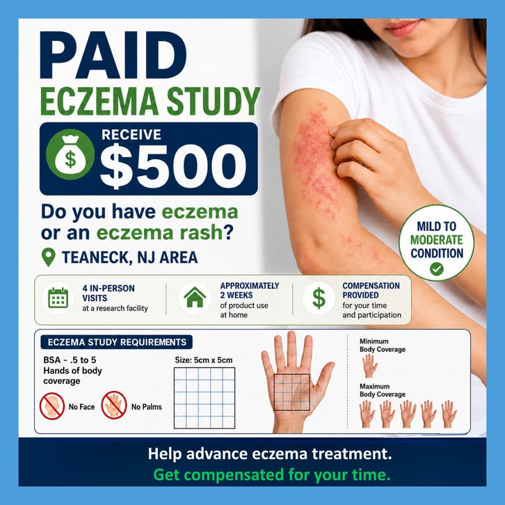 $500 Paid Eczema Research Study - Ridgewood, NJ Patch
