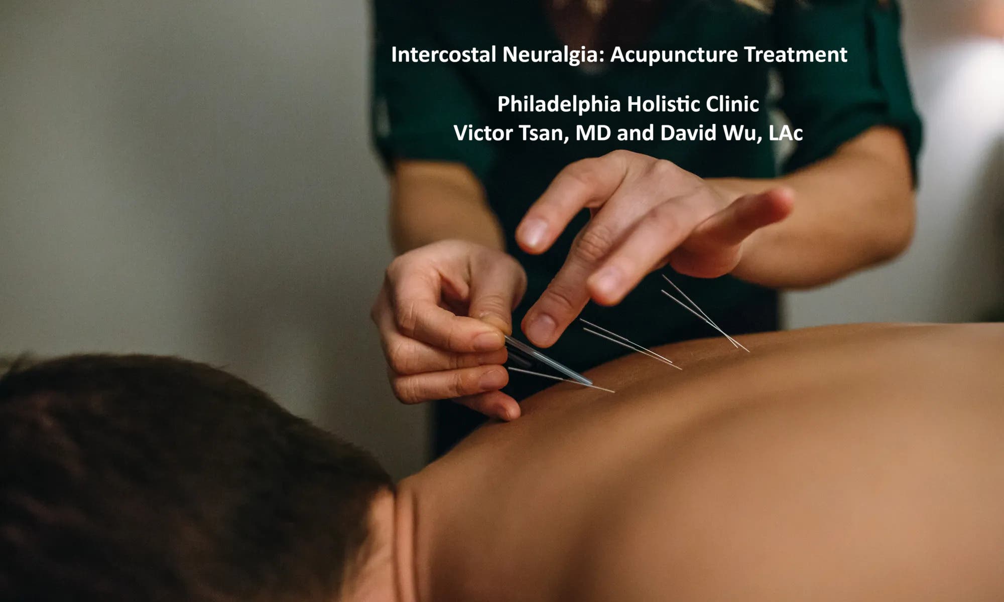 Intercostal Neuralgia Pain: Info, Relief & Tips - Philadelphia, PA Patch