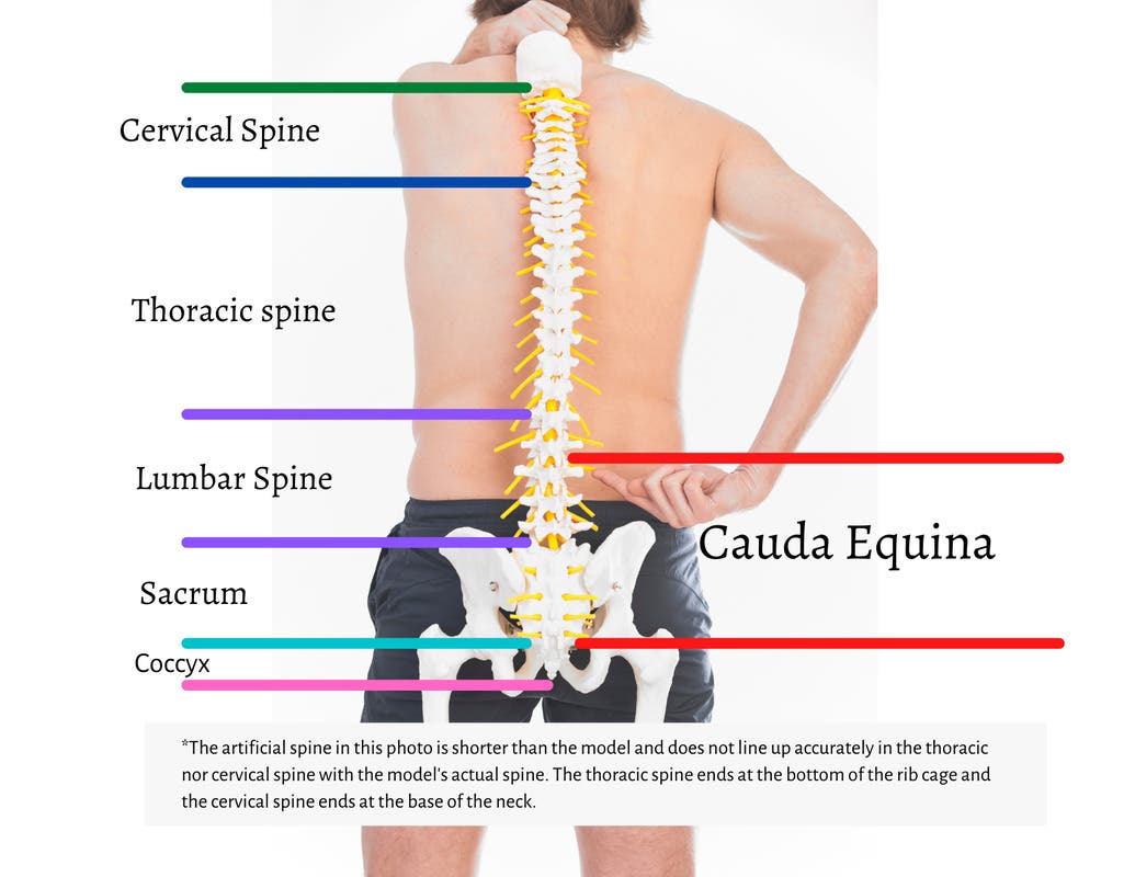 Cauda Equina Syndrome: Causes, Symptoms, and Holistic Treatments ...