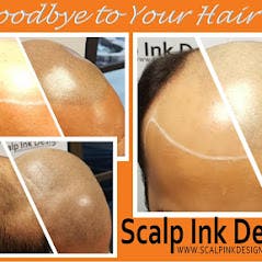 Scalp Ink Design - West Palm Beach, FL Patch