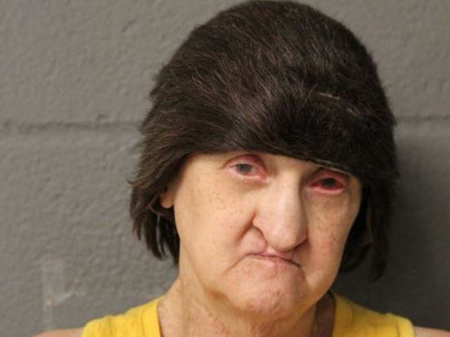 Legal Guardian Accused Of Trying To Suffocate 6-Year-Old Ward | Oak ...