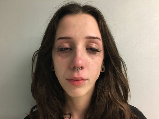 3rd Suspect In Concord Homeless Camp Shooting, 'Woman With Uzi-Style ...